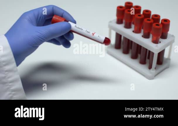Negative Rubella test, doctor showing blood sample, lab research ...