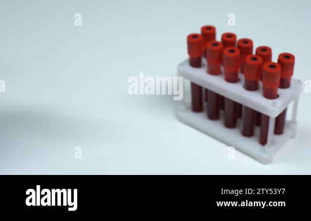 Negative EV 71 test, doctor showing blood sample, lab research, health ...