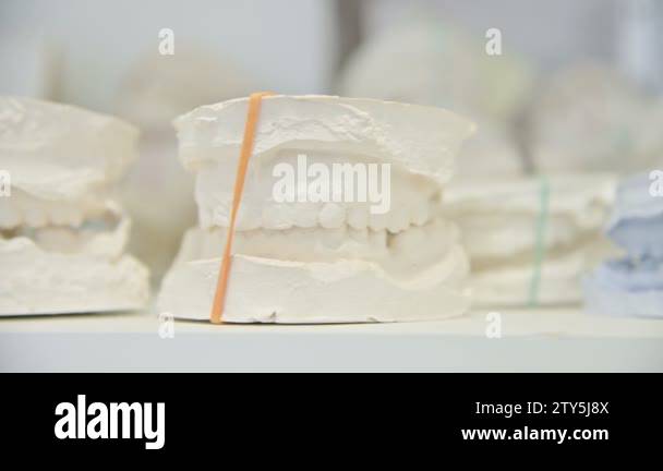 Dental gypsum model cast of human dental jaw. Laboratory prosthetics ...