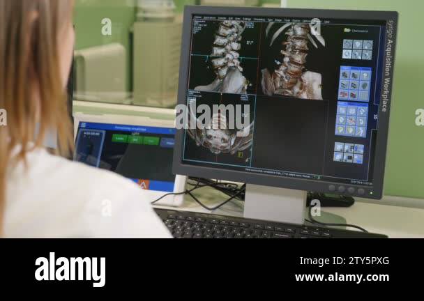 Healthcare concept. Doctor in Hospital looking at CT scan. Over the Shoulder Shot of female ...