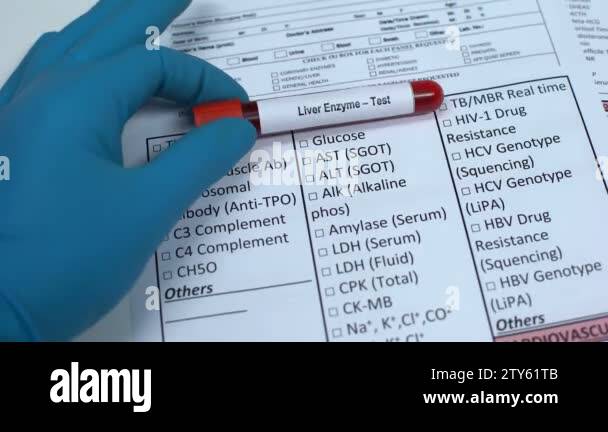 Liver enzyme, doctor checking name in lab blank, showing blood sample ...