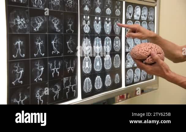 Doctor demonstrating brain model anatomy and MRI imaging on light box ...