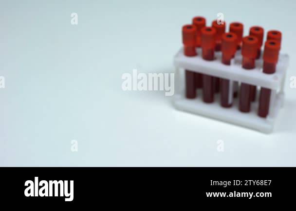 Western blot, doctor showing blood sample in tube, lab research, health ...