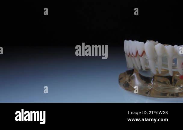 Close - up of teeth with examples of defects and bad teeth Stock Video ...