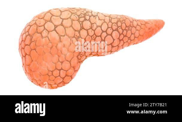 Disease spread on pancreas, 3d animation. 3D rendering isolated on ...