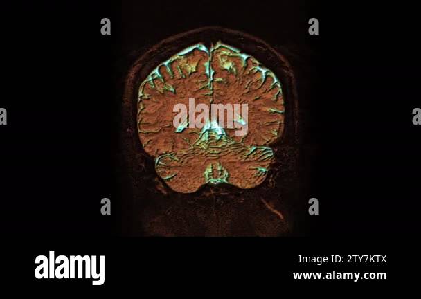 Bulk multicolored MRI scans of the brain and head to detect tumors ...