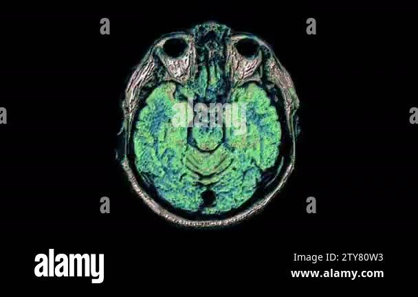 Bulk multicolored MRI scans of the brain and head to detect tumors ...