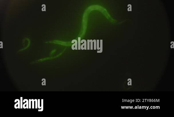 Highlighted green microorganisms, c-elegans (Caenorhabditis elegans) nematode worms under the ...