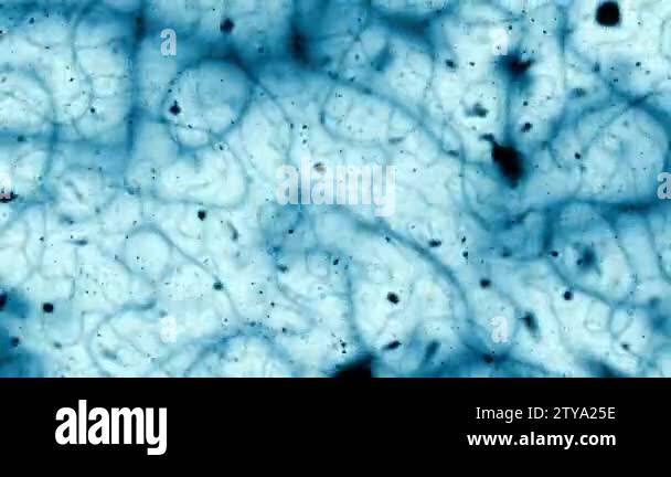 embryonic stem cells colony under a microscope cellular therapy and ...
