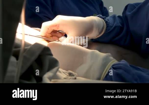 Surgical suture Stock Videos & Footage - HD and 4K Video Clips - Alamy