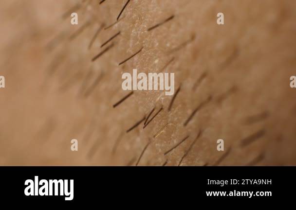 Macro of bristle. Non groomed and unshaven male facial skin with hairs ...