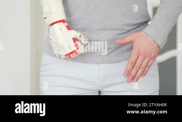 Patient is testing his new robotic prosthetic hand on the first time ...