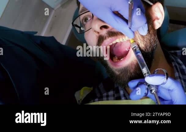 Anesthesia injection in patient tooth. Man with open mouth during ...
