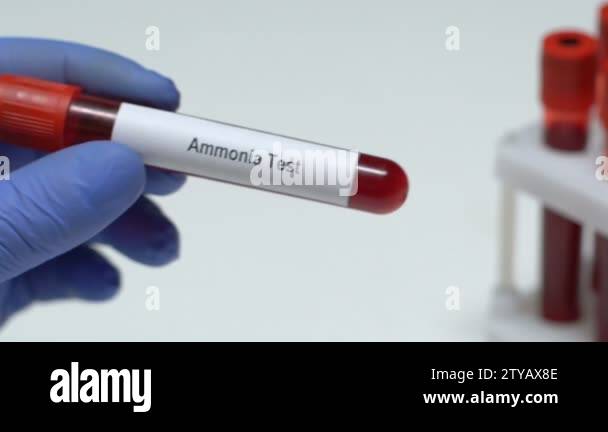 Ammonia Test, doctor holding blood sample in tube close-up, health ...