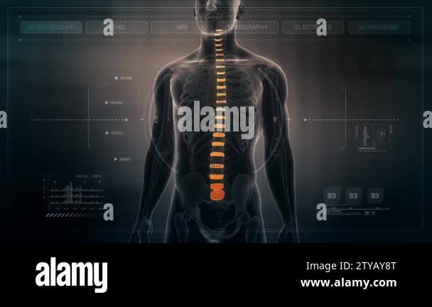 Anatomy of Human Male Spinal Discs on Futuristic Medical Interface ...