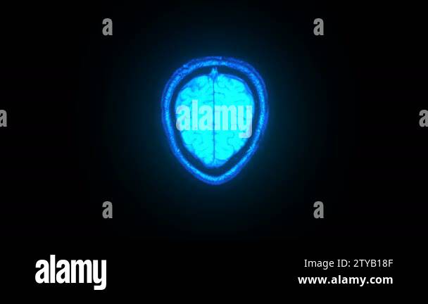 Magnetic Resonance Imaging MRI scan of a Human brain, ultra hd 4k, time ...