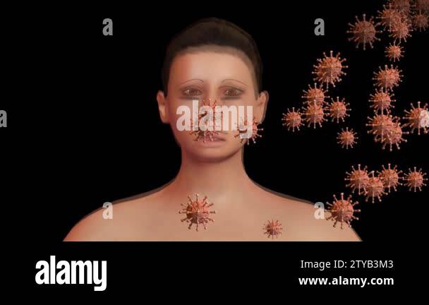 woman being infected with the 2019-nCov coronavirus that causes severe ...