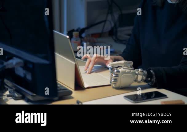 Disabled person with bionic hand types on a laptop. Metal prosthetic ...