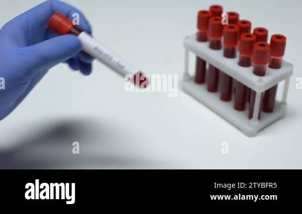 Beta hCG test, doctor showing blood sample in tube, lab research ...