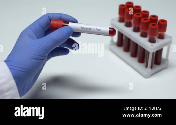 Troponin t test Stock Videos & Footage - HD and 4K Video Clips - Alamy