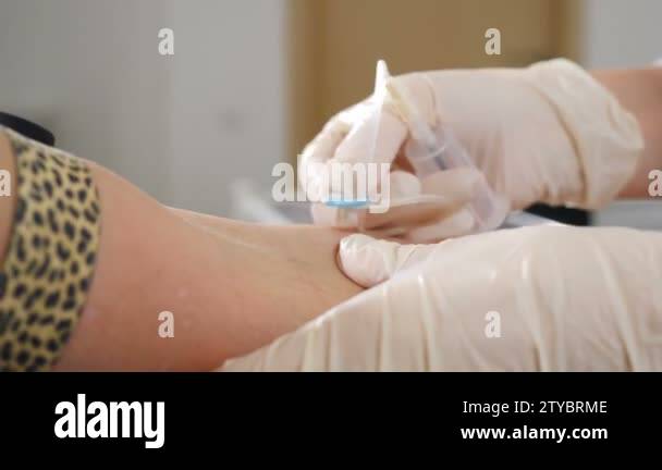 Blood sample taking procedure in laboratory. Sampling blood from vein ...