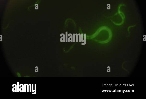 Highlighted green microorganisms, c-elegans (Caenorhabditis elegans) nematode worms under the ...