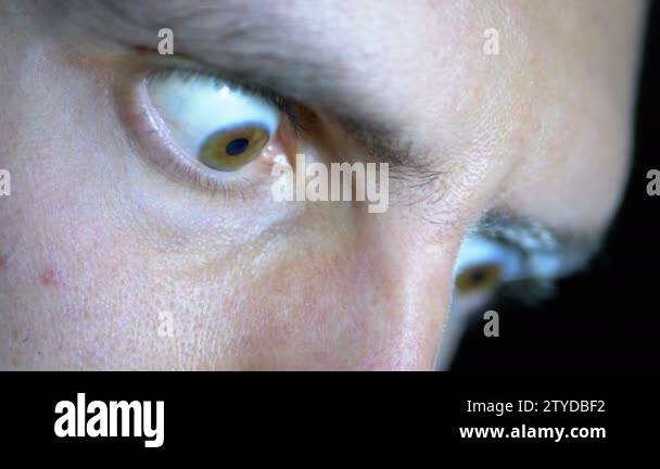 Bulging eyeball Stock Videos & Footage - HD and 4K Video Clips - Alamy