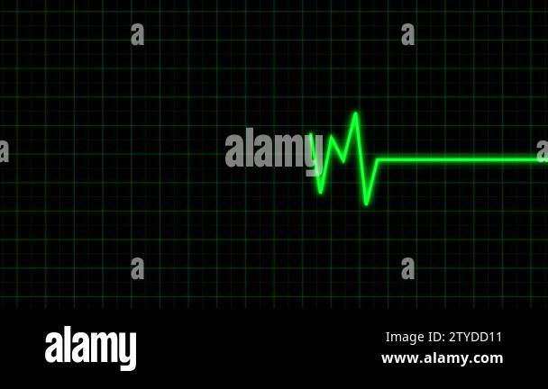 Ecg tracing monitor Stock Videos & Footage - HD and 4K Video Clips - Alamy
