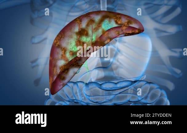 The anatomy of the human liver and its location in the body Stock Video ...