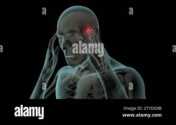 3d headache Stock Videos & Footage - HD and 4K Video Clips - Alamy