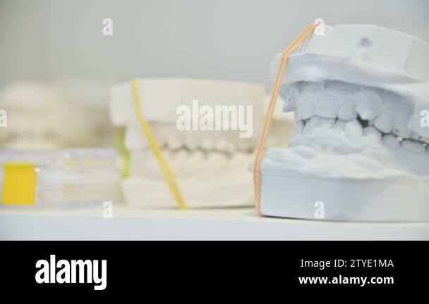 Dental gypsum model cast of human dental jaw. Laboratory prosthetics ...