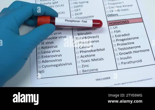 Mineral phosphorus Stock Videos & Footage - HD and 4K Video Clips - Alamy