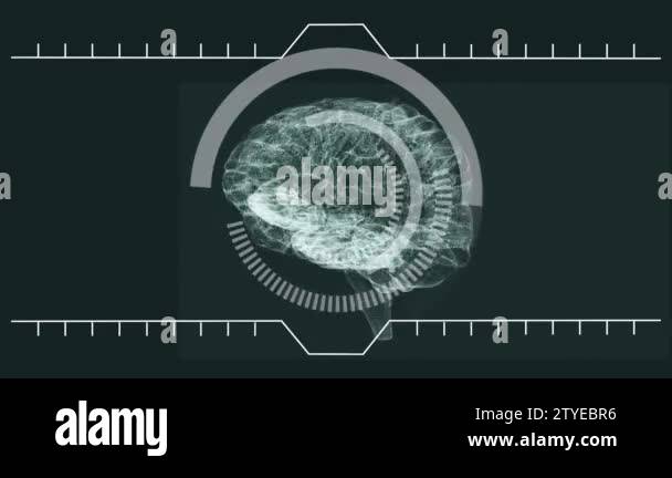 Montage cerebral Stock Videos & Footage - HD and 4K Video Clips - Alamy