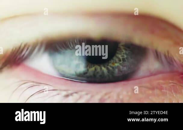 Macro View of Pupil Constriction Process in Human Eye. Constriction of ...