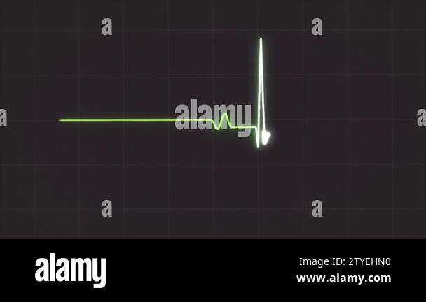 Abstract EKG Monitor showing heart beat on grey background ...