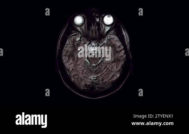 Voluminous color MRI scans of the brain and head to detect tumors ...