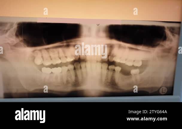 360 degree x ray Stock Videos & Footage - HD and 4K Video Clips - Alamy