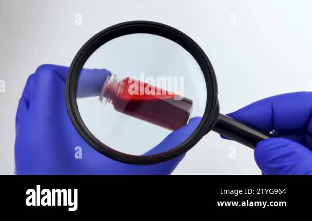 Blood sample for test. The doctors hand holds a magnifying glass in ...