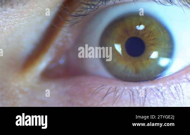 Crazy and Fear Look of Human Eye. The wide-open Eyeball, turns in panic ...