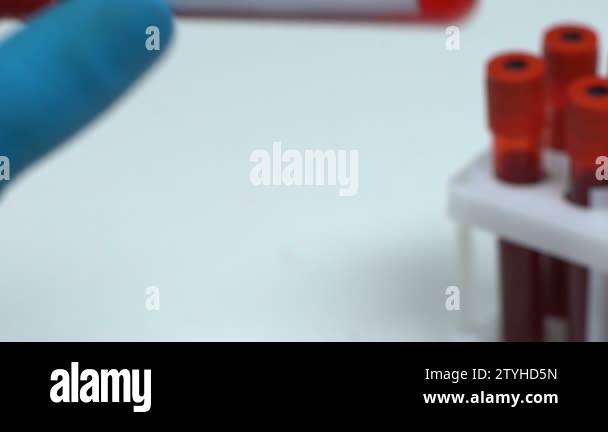 Dengue-test, doctor holding blood sample in tube close-up, health check ...