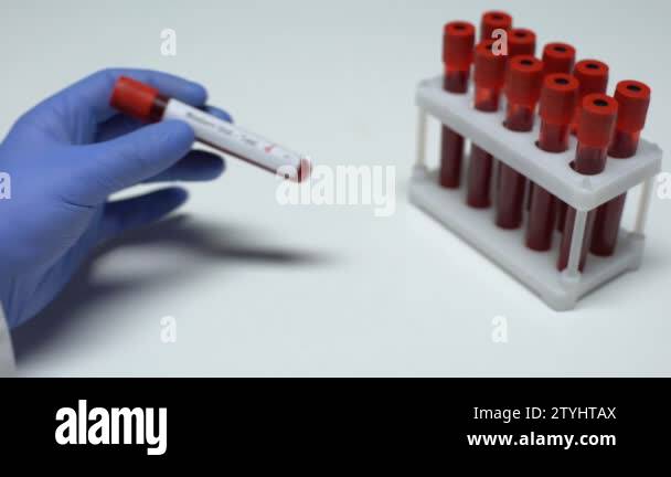Western blot Stock Videos & Footage - HD and 4K Video Clips - Alamy