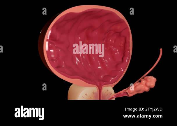 This 3D video shows an overview of the bladder and prostate Stock Video Footage - Alamy