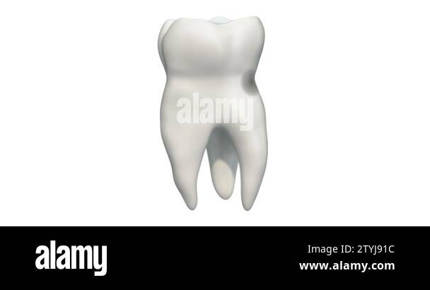 Tooth cavities illustration Stock Videos & Footage - HD and 4K Video ...