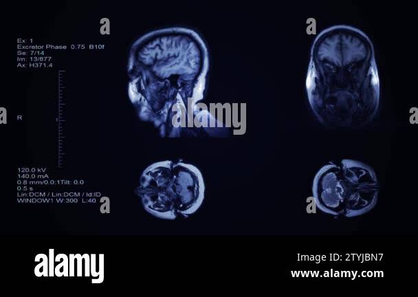 Head and brain computer tomography result visualization. Four ...