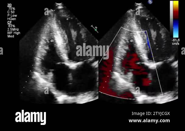 Ultrasound doppler Stock Videos & Footage - HD and 4K Video Clips - Alamy
