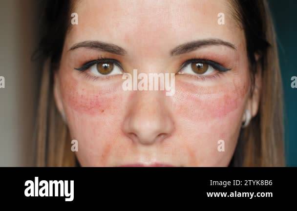 Swelled up person Stock Videos & Footage - HD and 4K Video Clips - Alamy