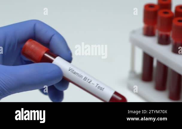 Vitamin B12-Test, doctor holding blood sample in tube close-up, health ...