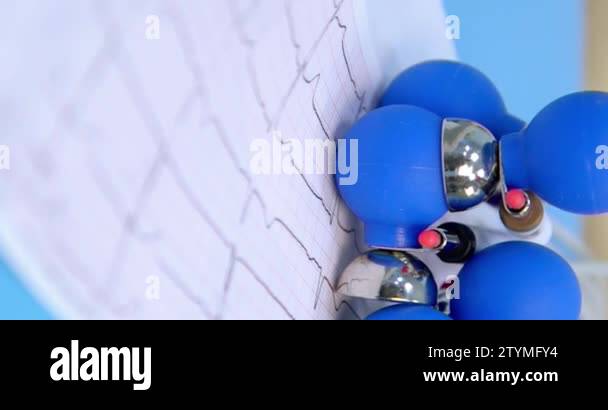 Medical heart monitor strip. Heart monitor printing electrocardiogram ...