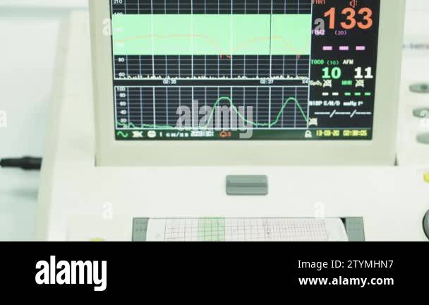 EKG monitor Cardiograph. Cardiograph display during the measurement of ...