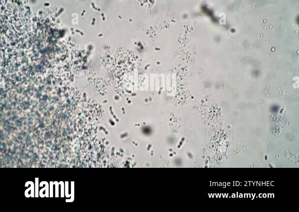 Camera on a microscope Stock Videos & Footage - HD and 4K Video Clips ...